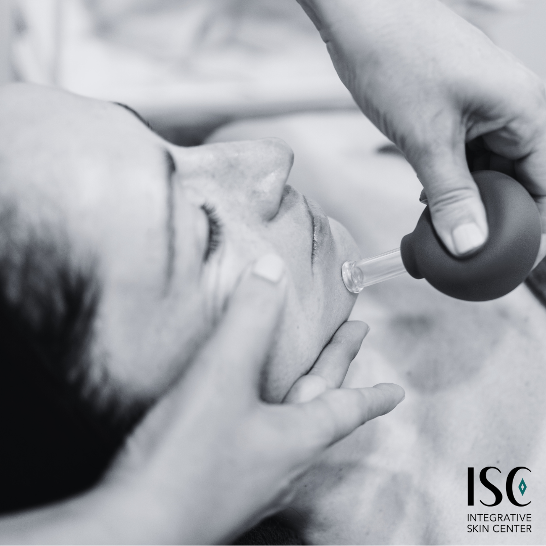 Why Choose Facial Cupping? Unveiling its Unique Benefits